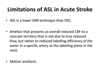 Arterial Spin Labelling in stroke | PPTX