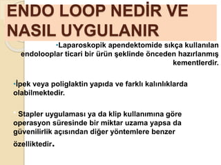 Bant Ligasyon Endo Loop Uygulama Yontemleri | PPTX