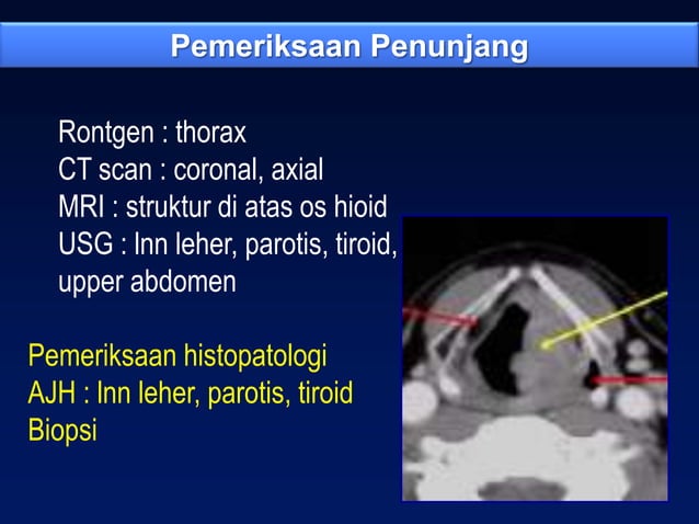 Deteksi dini keganasan Kepala Leher | PPTX | Ear, Nose and Throat ...