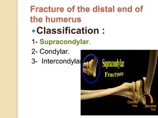 Fracture & dislocation around the elbow | PPTX
