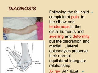 Elbow Fracture Dislocation