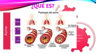 Asma: Semiología, tipos y características clínicas. | PPTX