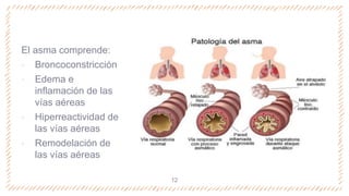 Farmacoterapia del Asma | PPTX
