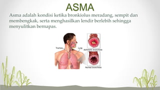 Asma - Ilmu Penyakit | PPTX