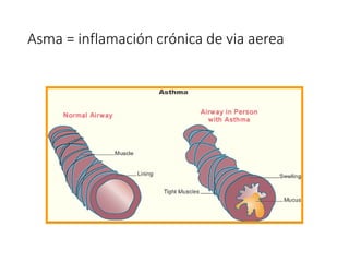 Asma | PPT