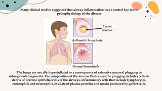 Asma.pptx | Lung and Respiratory Health | Diseases and Conditions