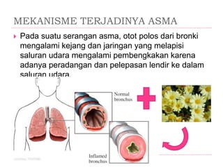 ASMA PPT DISEASE LUNGS HUMAN BODY MEDICINE | PPTX