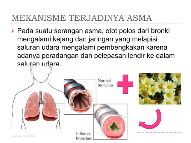 ASMA PPT DISEASE LUNGS HUMAN BODY MEDICINE | PPT