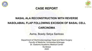 case report nasolabial flap nasal ala recons with reverse nasolabial ...