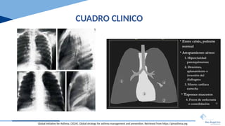 ASMA PRESENTACION PPT MEDICINA INTERNA NEUMOLOGIA | PPTX