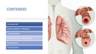 ASMA PRESENTACION PPT MEDICINA INTERNA NEUMOLOGIA | PPTX