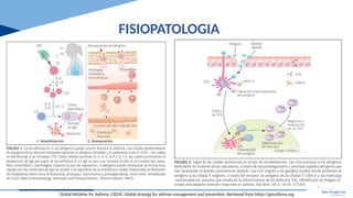 ASMA PRESENTACION PPT MEDICINA INTERNA NEUMOLOGIA | PPTX