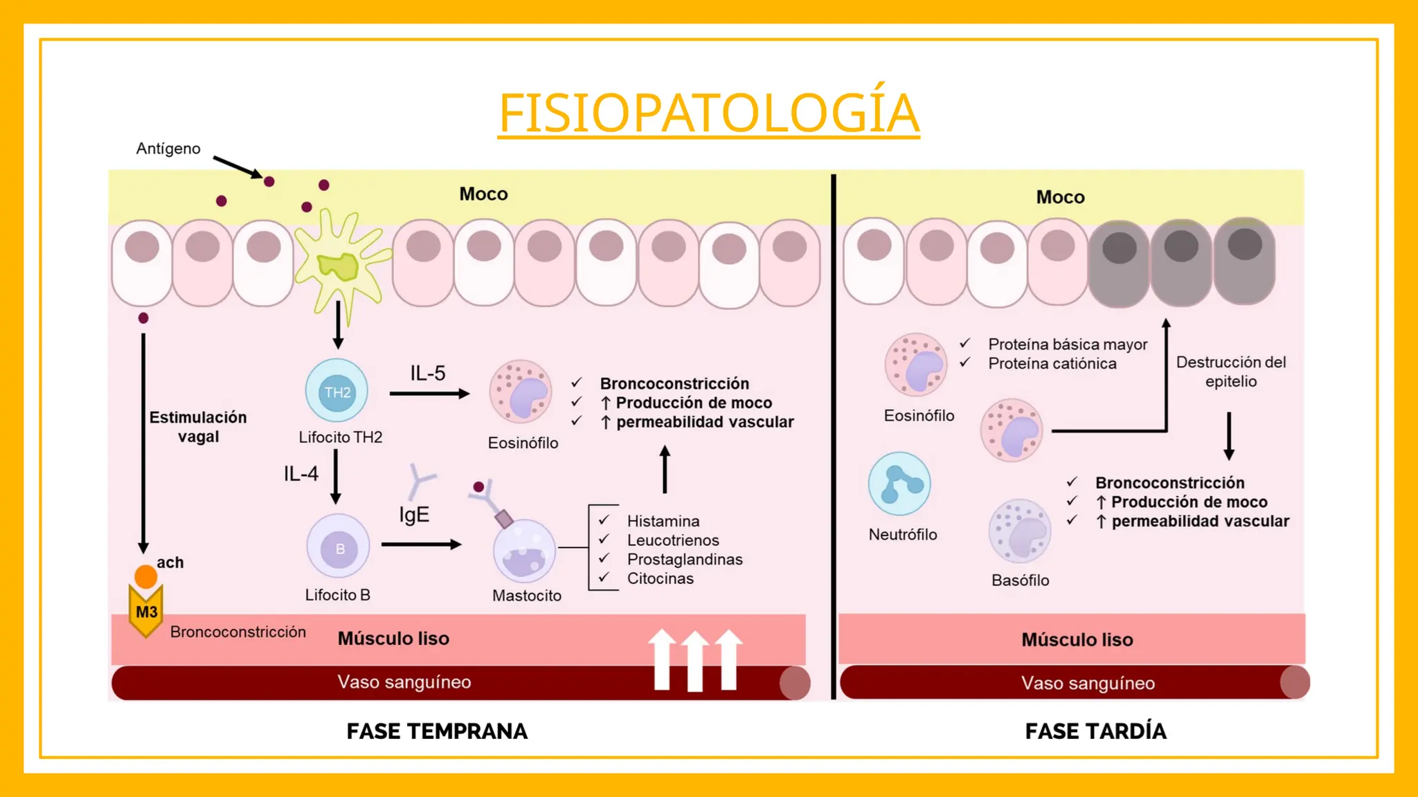 Fisiopatología del asma bronquial en adultos. | PPTX