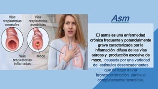 Asma Bronquial - Neumología y pediatriaAdamilca.pptx