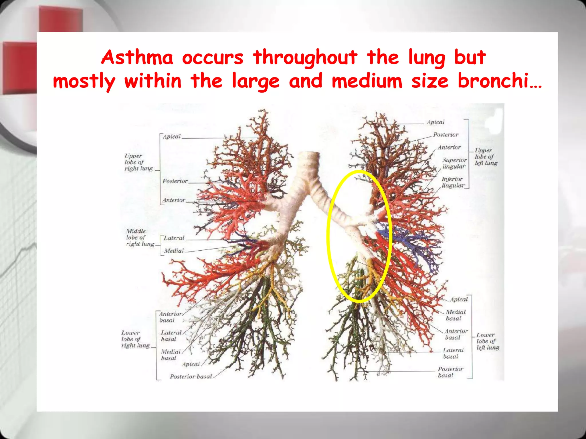 Asma bronkial-ppt | PPT