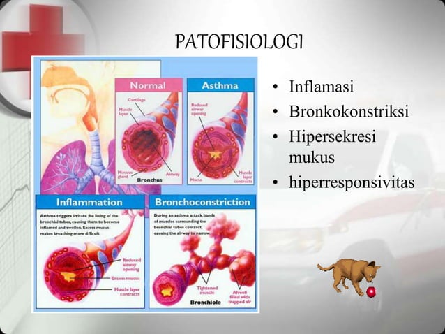 Asma bronkial-ppt | PPT