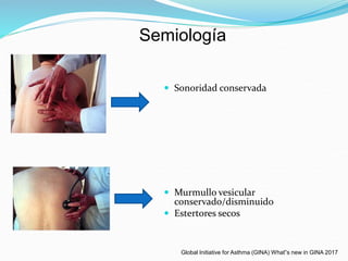 ASMA-BRONQUIAL.ppt diagnóstico y tratamiento | PPT