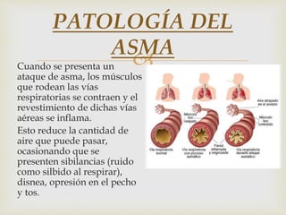 Asma diapositiva | PPTX