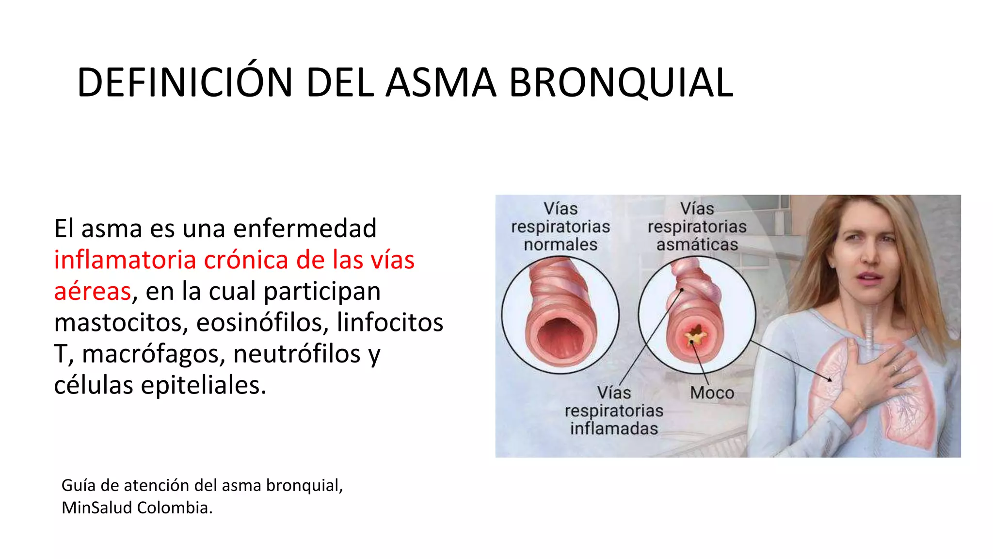 Asma bronquial | PPT