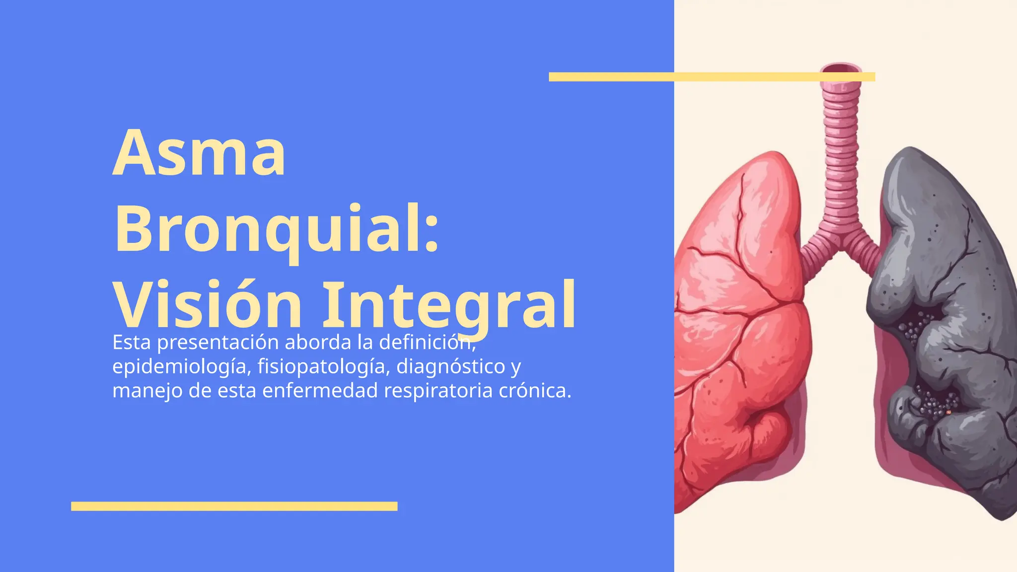 Asma Bronquial Vision Integral 2025.pptx
