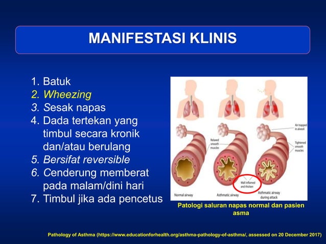 ASMA EKSASERBASI.ppt