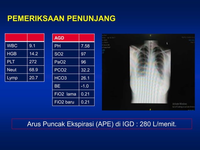 ASMA EKSASERBASI.ppt