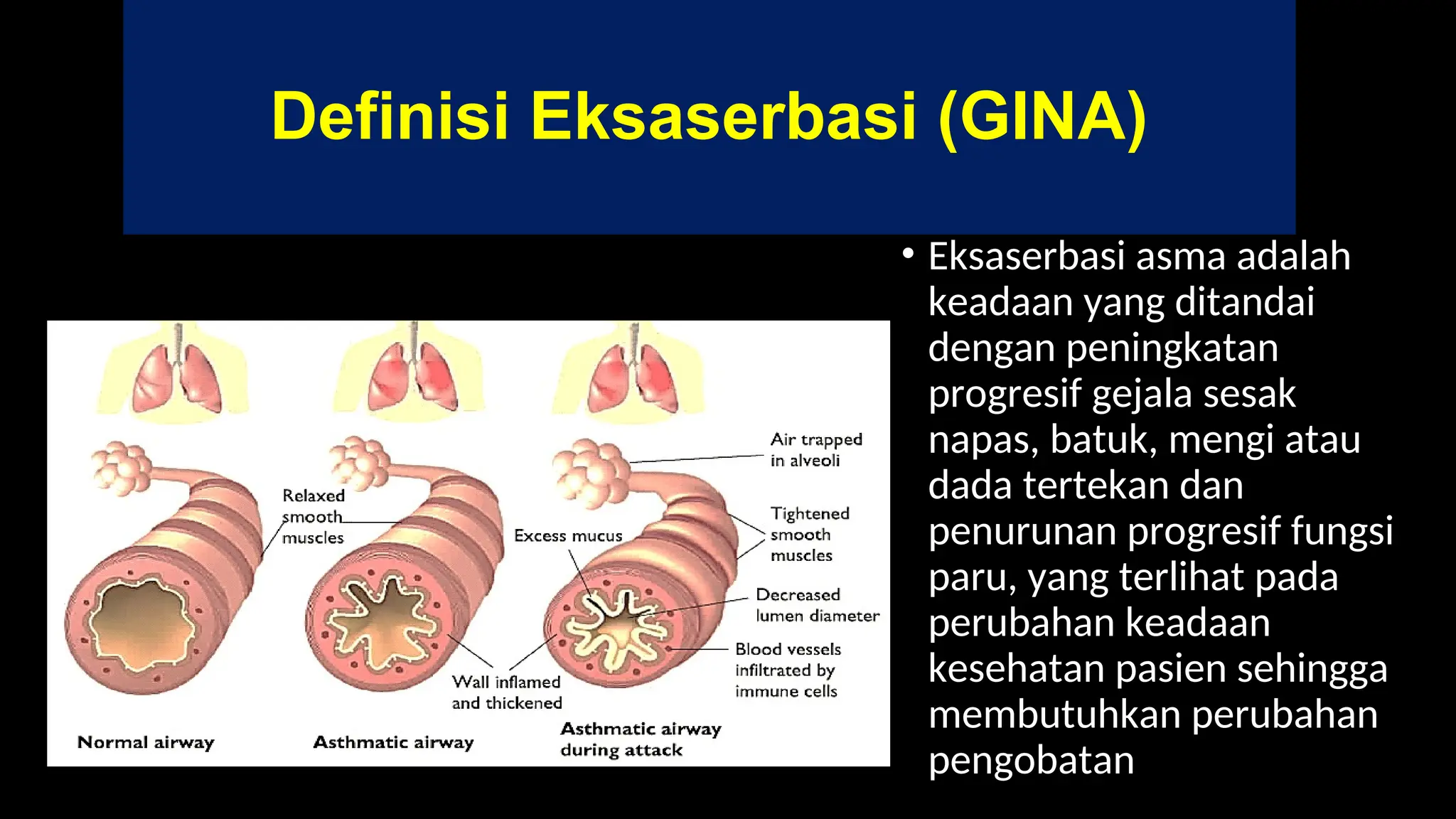 Penatalaksanaan asma eksaserbasi di fasilitas kesehatan | PPT