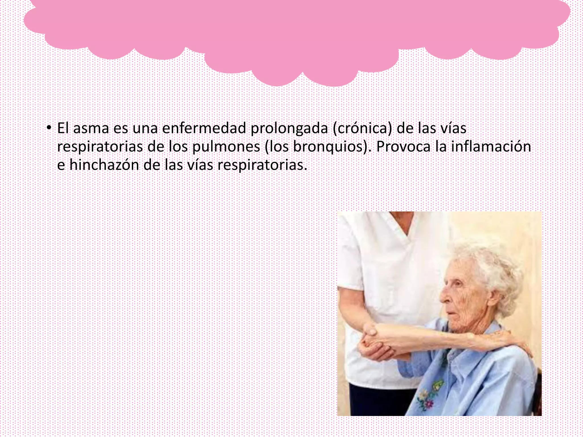 Asma en el adulto | PPT