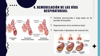 Asma Bronquial E Hiperreactividad Bronquial Pptx