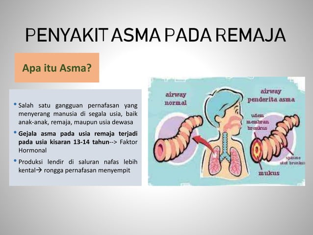 Asma_Poster 1 Lembar.pptx
