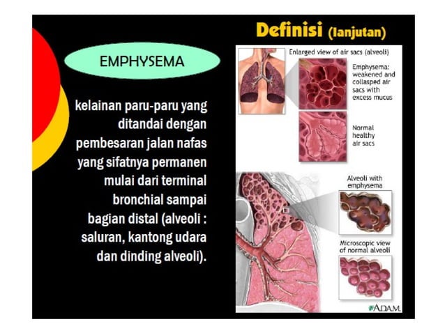 Asma & ppok | PPT