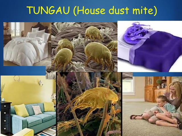 power point tentang asma dan ppok/penyakit paru | PPT