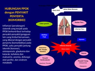 power point tentang asma dan ppok/penyakit paru | PPT