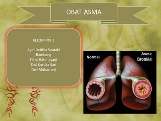 Asma ppt (2) | PPTX