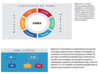 ASMA PRESENTACION.ppt
