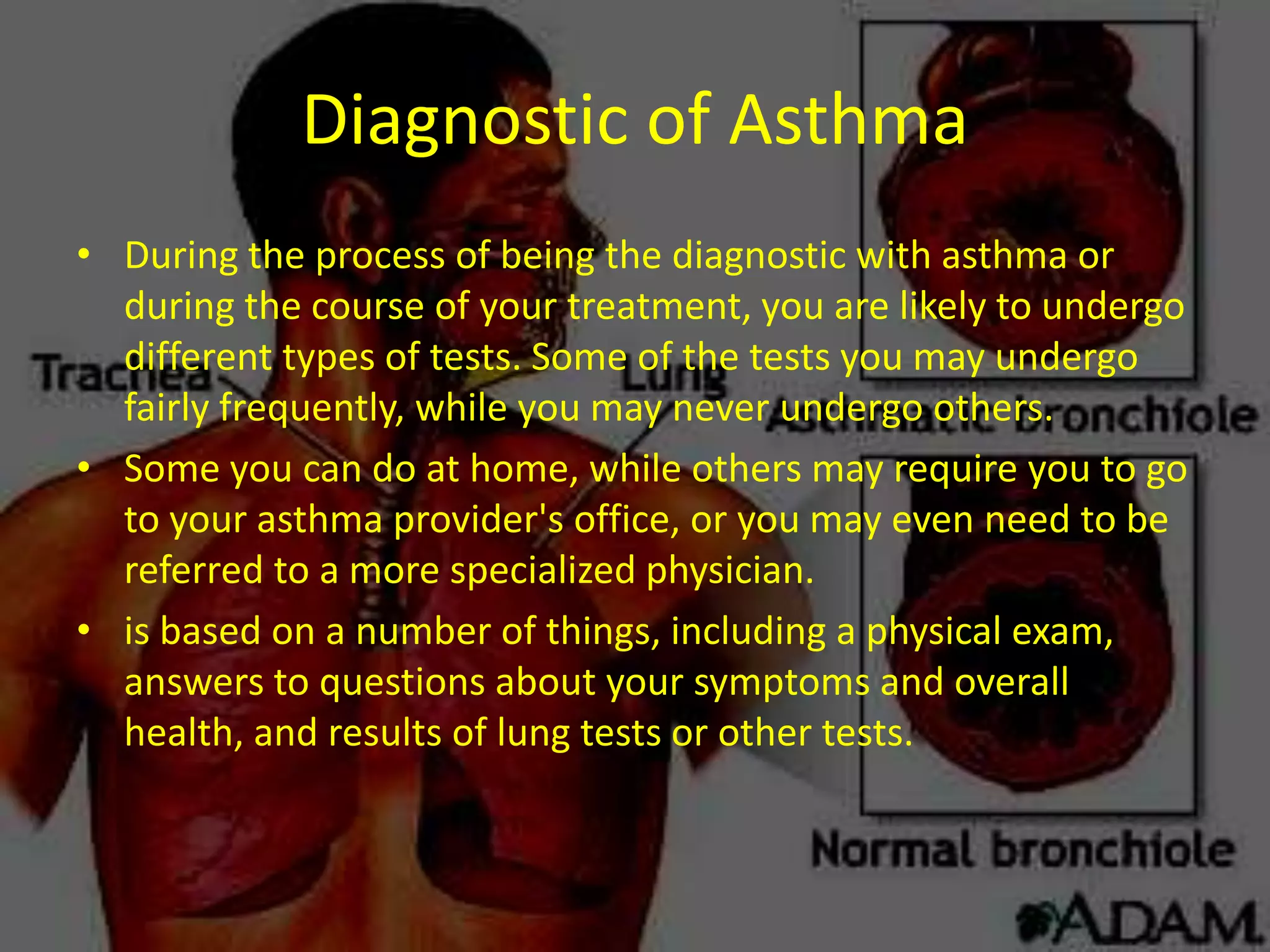 Asma presentation | PPTX