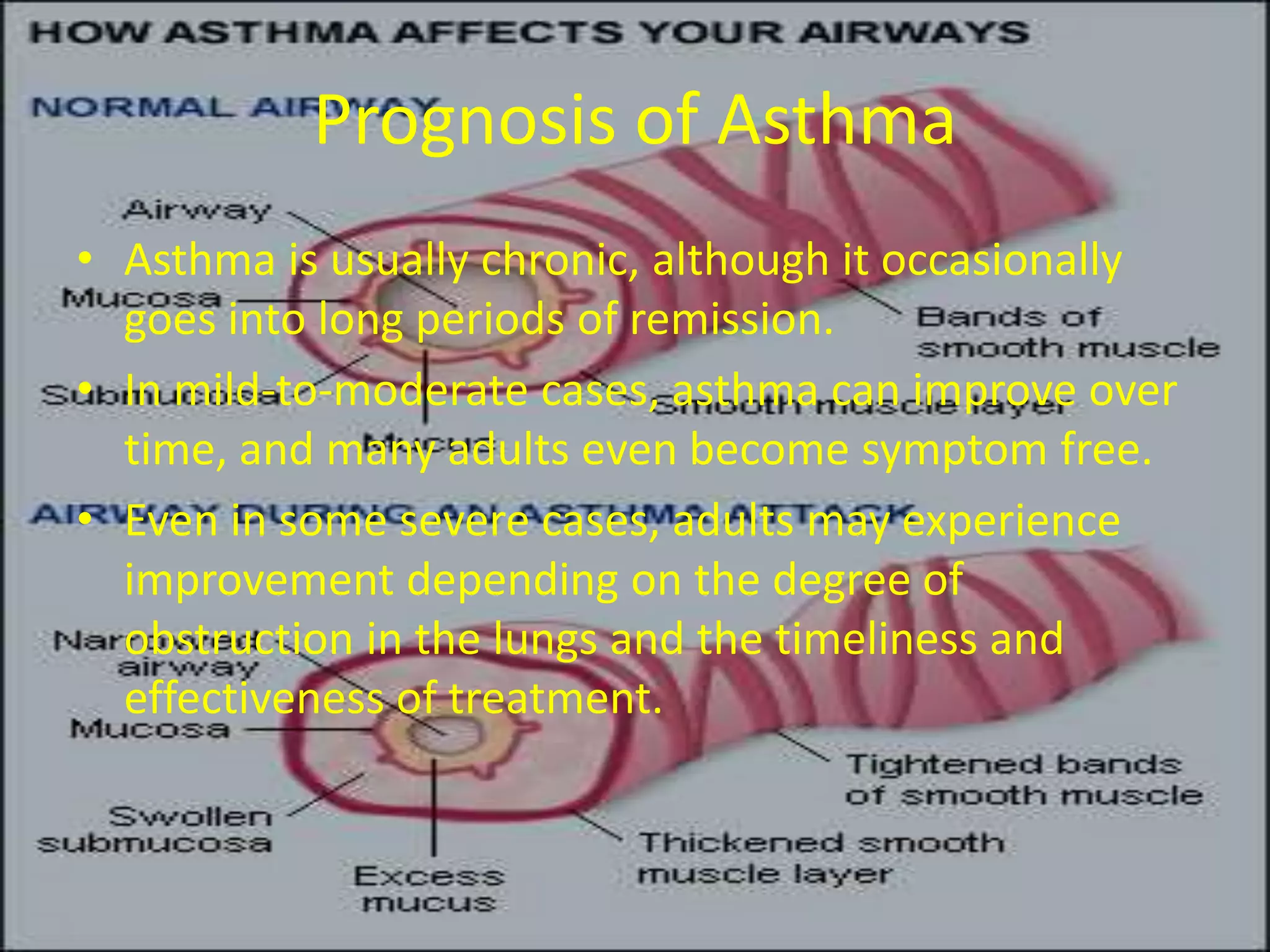 Asma presentation | PPTX