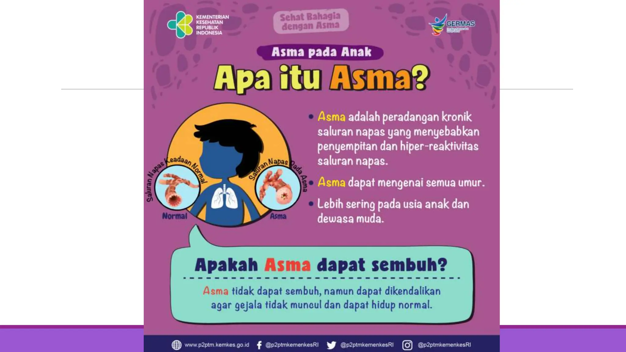 PENYAKIT ASMA PADA USIA LANJUTPROLANIS .pptx