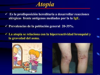 Asma Bronquial. Atención Primaria | PPTX