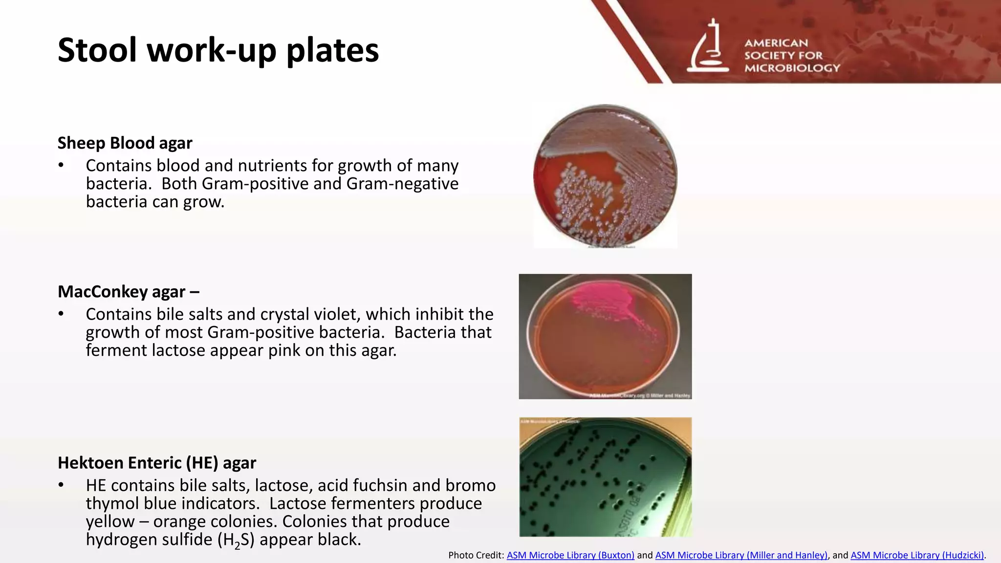 ASM_CPHMC_Case_Study_Salmonella.pptx