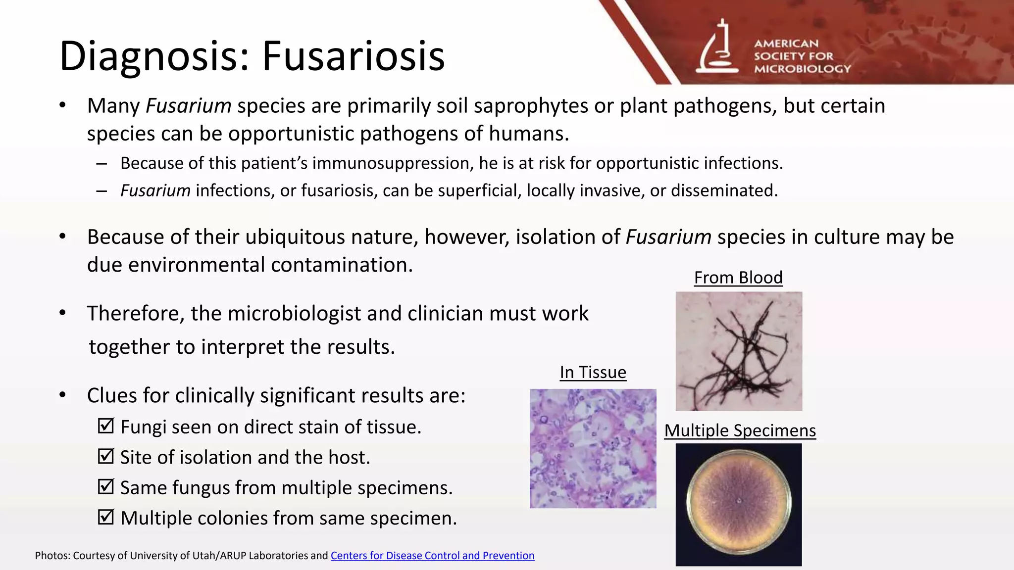 ASM_CPHMC_Case_Study_Study_Invasive-Fungal-Infections-Identification ...