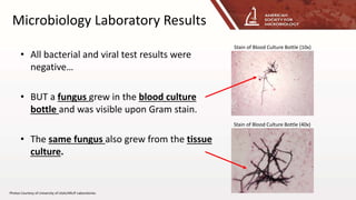 ASM_CPHMC_Case_Study_Study_Invasive-Fungal-Infections-Identification ...