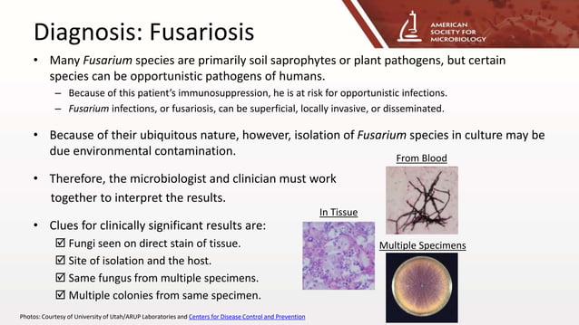 ASM_CPHMC_Case_Study_Study_Invasive-Fungal-Infections-Identification ...
