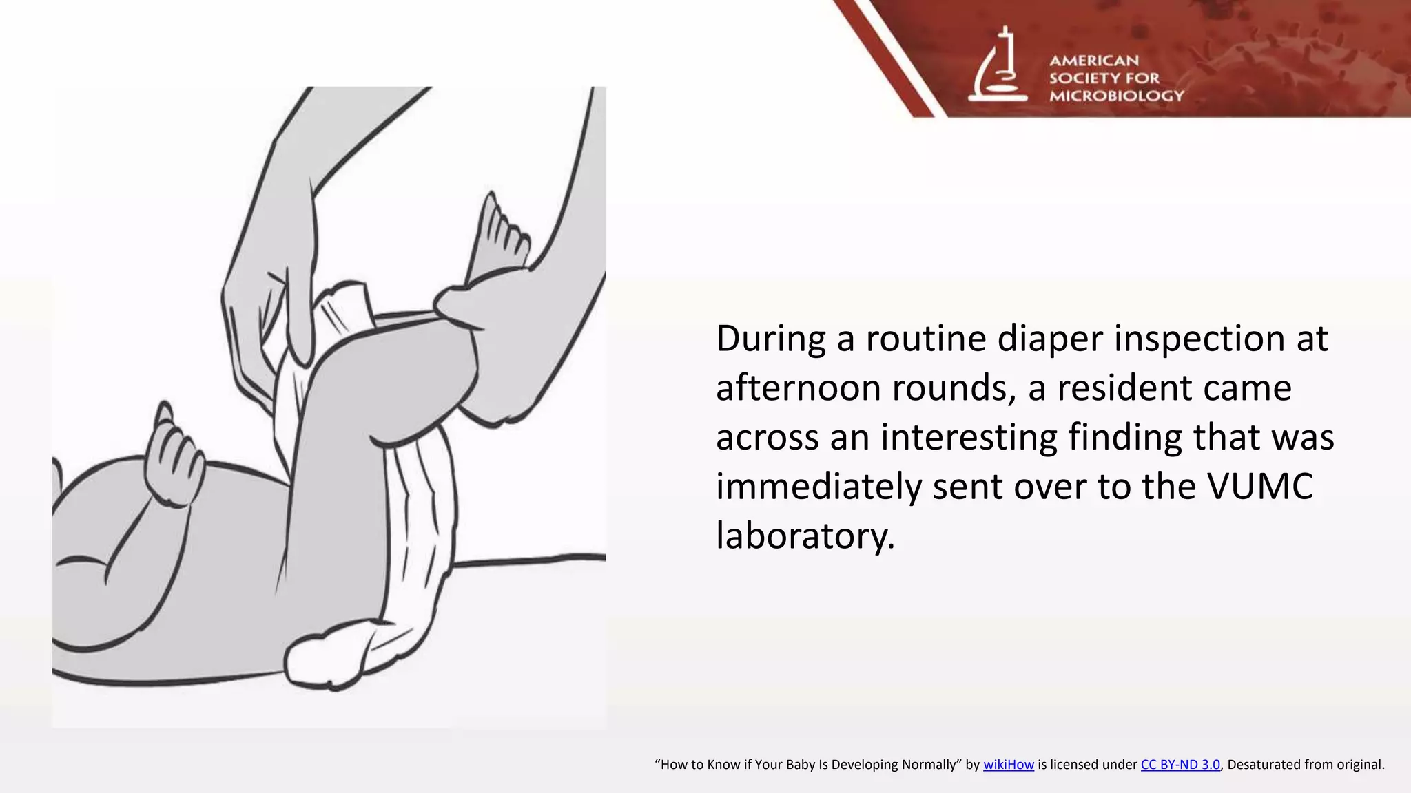 ASM_CPHMC_Case_Study_The-Unexpected-Diaper-Discovery.pptx
