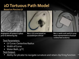Engineering a New Approach to Mitral Valve Regurgitation: Direct ...
