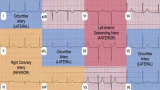 TYPES AND PATTERNS OF MYOCARDIAL INFARCTION.pptx