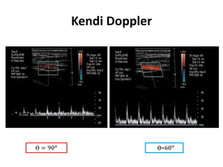Asmp ultratingujt-pjesa-fizike | PPTX
