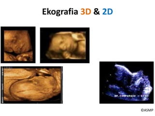 Asmp ultratingujt-pjesa-fizike | PPTX