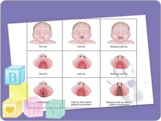 Asuhan neonatus | PPT