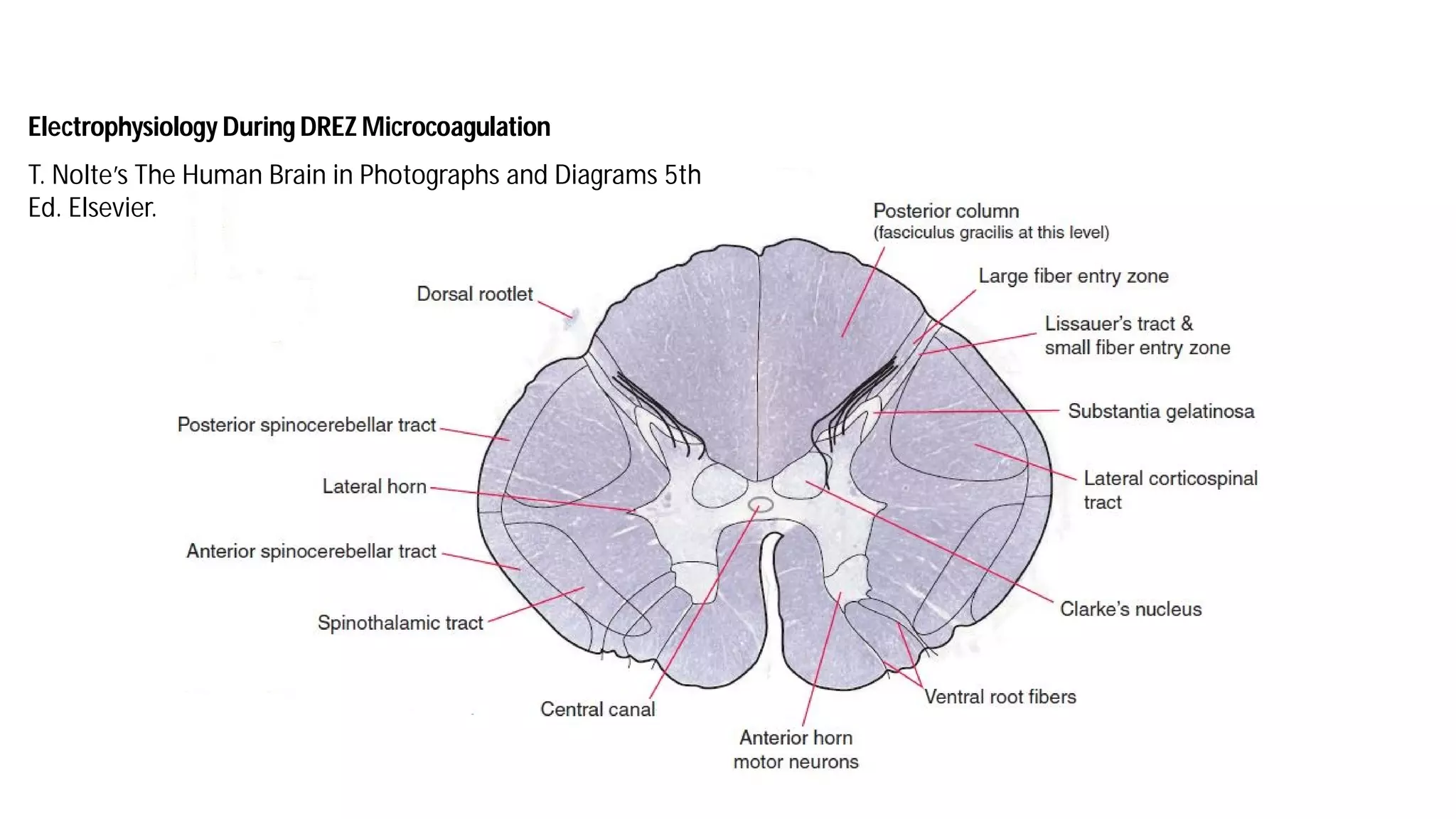 The Role of Electrophysiology During Dorsal Root Entry Zone ...